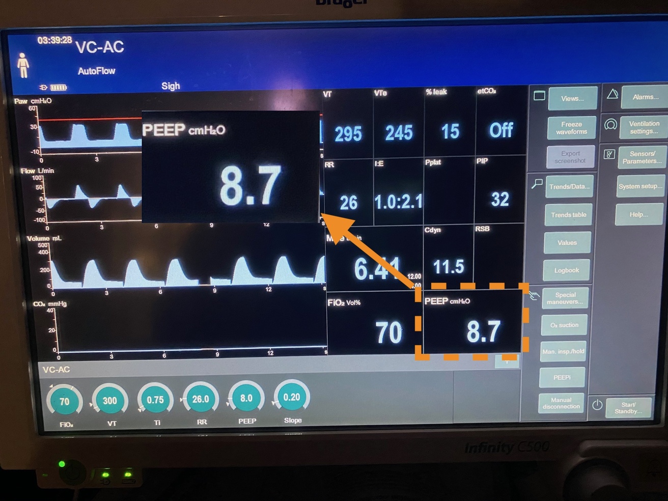 PEEP | Ventilator 101 - The University of Iowa