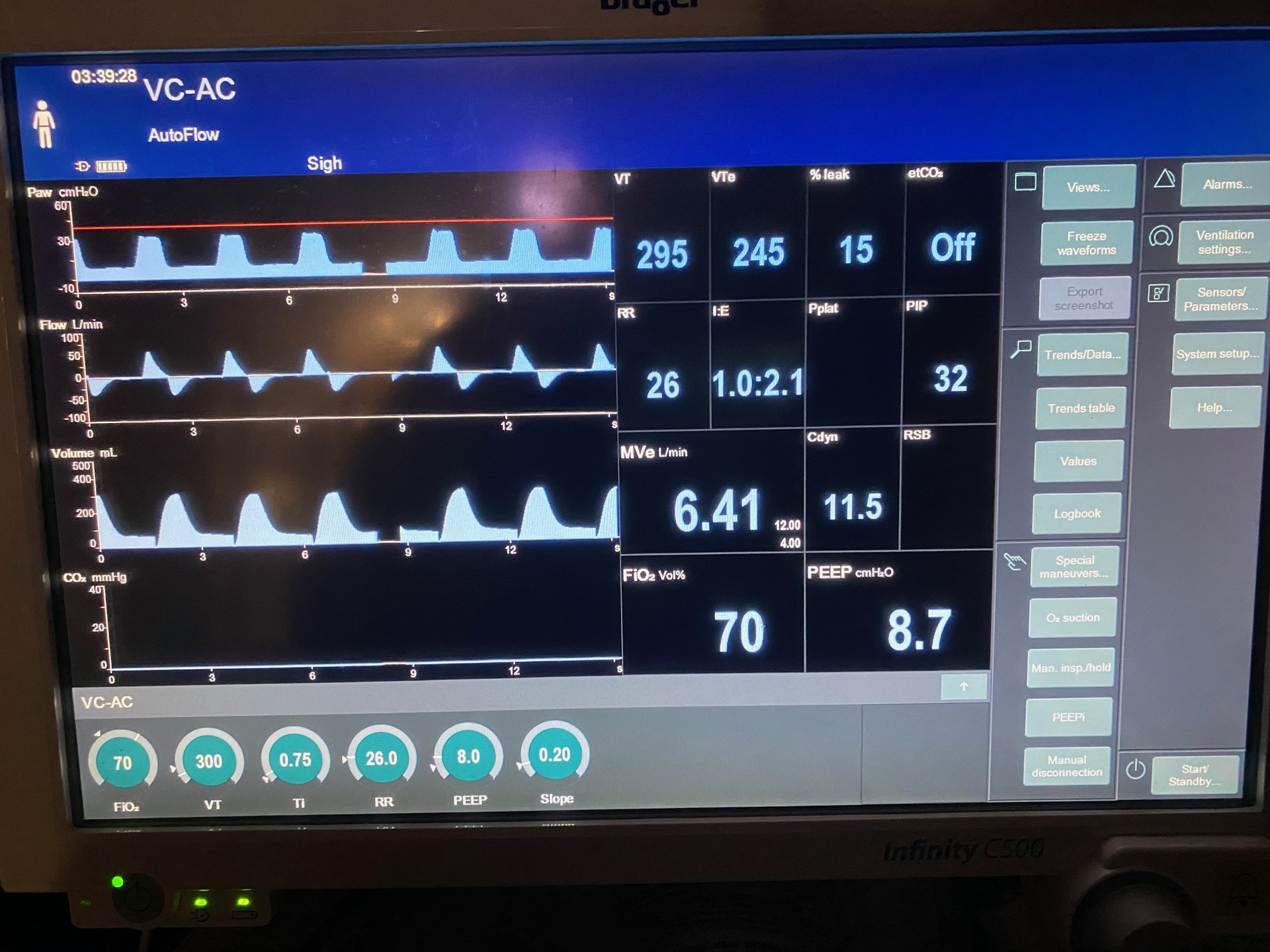 Interpreting the Pressure Waveform | Ventilator 101 - The University of ...